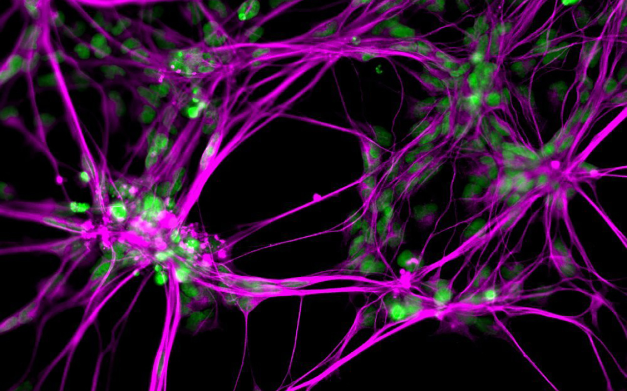 Nervesystemet – Nettskulen.no